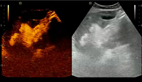Ultrasound's Colorful Canvas: A Comprehensive Study of the Contrast ...