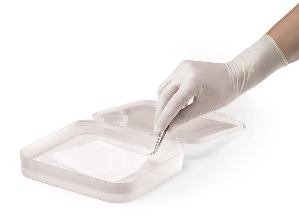 Transfer Membrane Market: Regaining Its Glory | Thermo Fisher ...