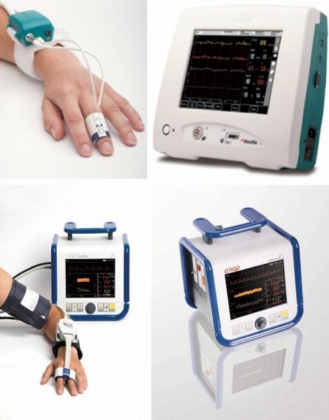 Non-invasive Pressure Monitoring Device Market Review: All Eyes on 2024 ...