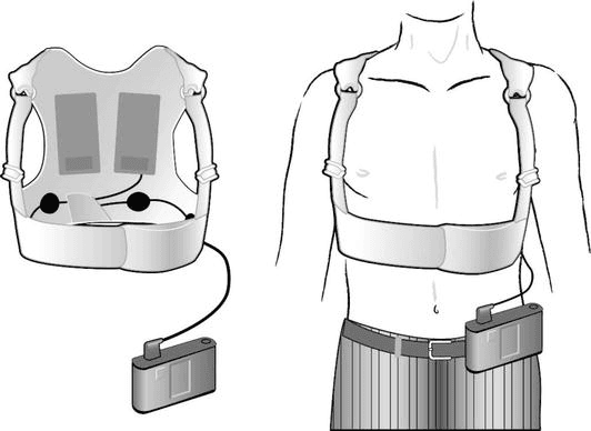 Wearable Cardioverter Defibrillators Market Review: All Eyes on 2024 ...