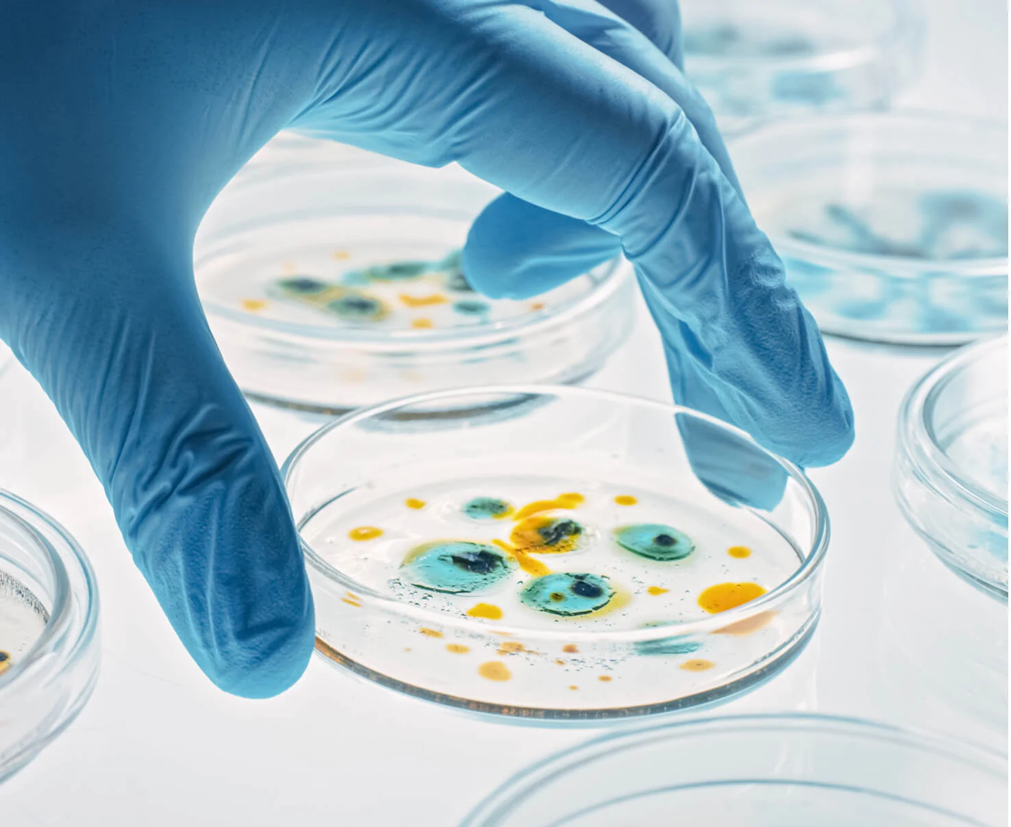 Microbial Fermentation Service Market Hits New High | Major Giants ...