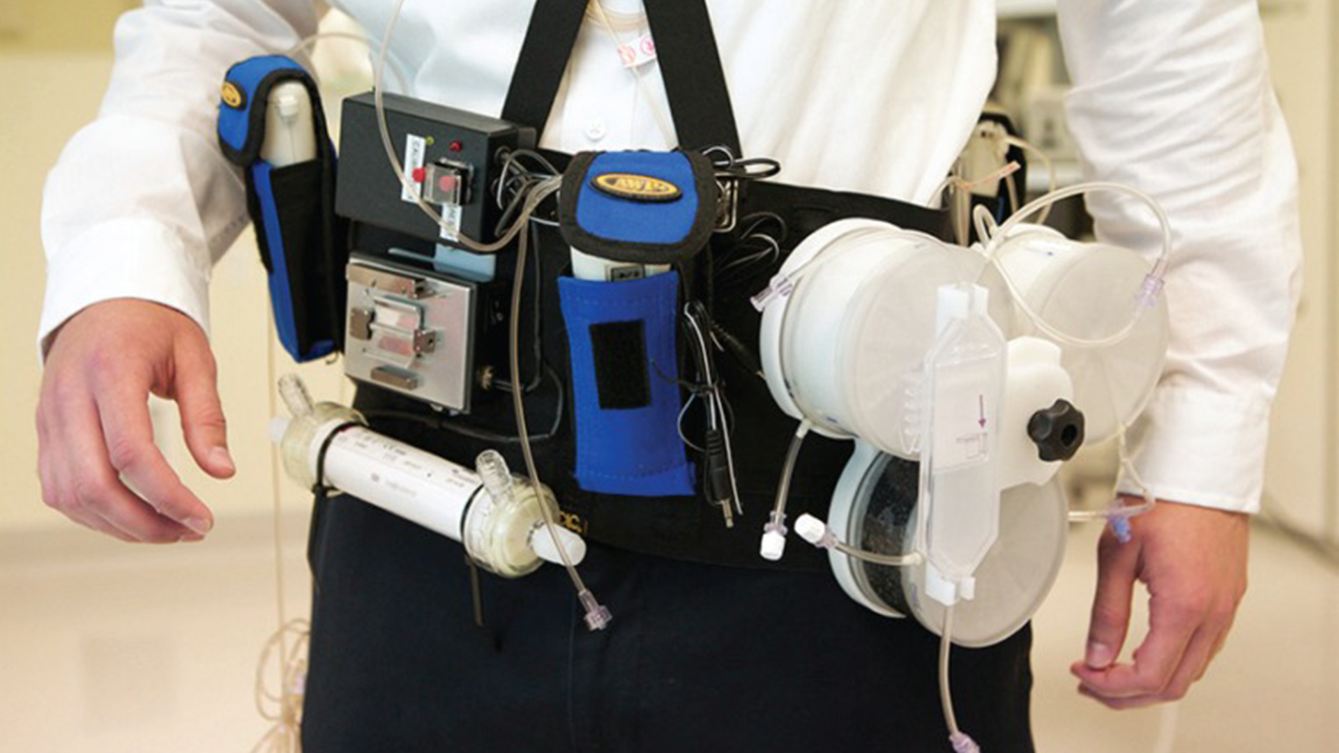Wearable Kidney Dialysis Device Market Going to Boom| Quanta Dialysis ...