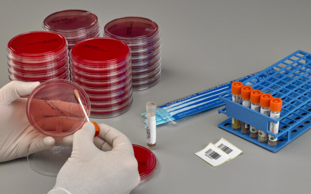 Bacterial And Viral Specimen Collection Market is Going To Boom | Roche ...