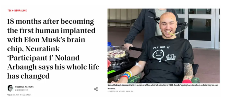 The interview with the first recipient of Musk's brain-computer ...