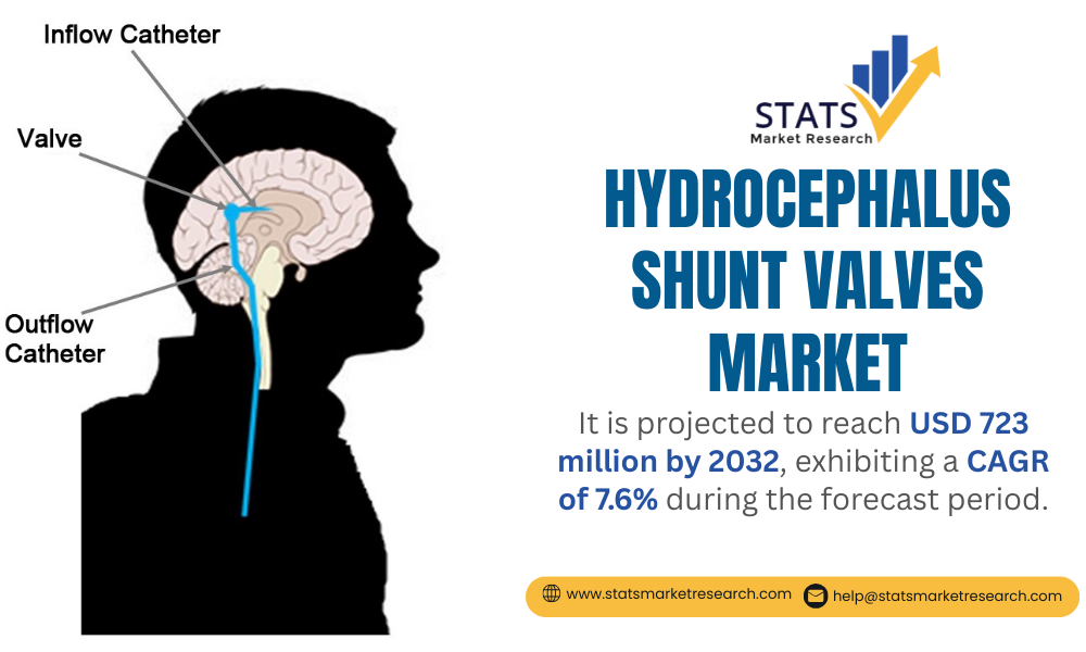 Global Hydrocephalus Shunt Valves Market to Reach USD 723 Million by ...