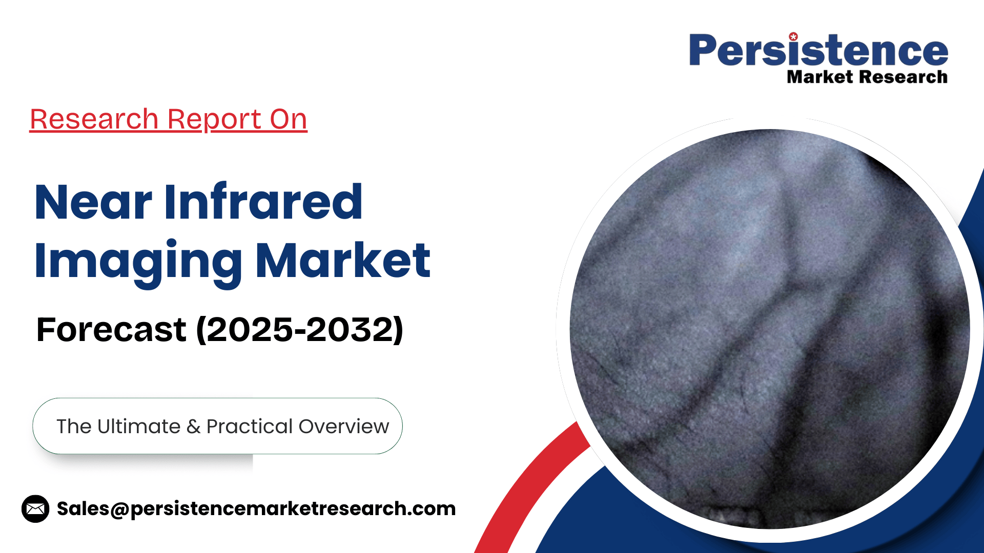 Near Infrared Imaging Market Expands with Rising Use in Disease ...