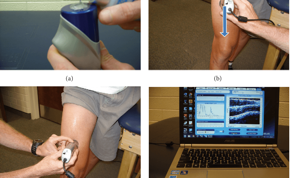 Ultrasonic Sound Body Composition Market are made an overview to the ...