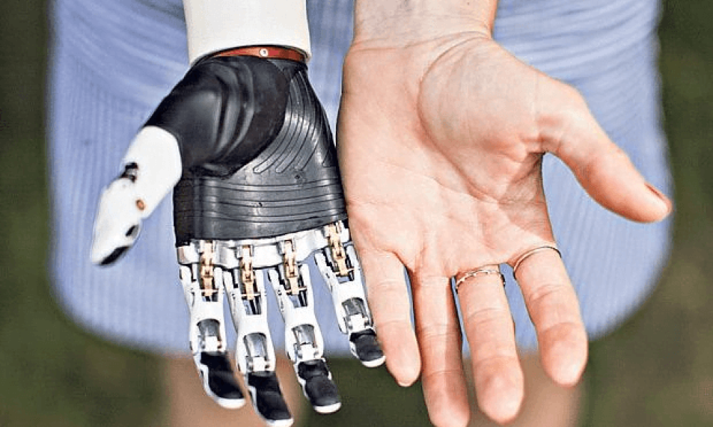 Artificial Organ & Bionics Market Will Hit Big Revenues in Future ...