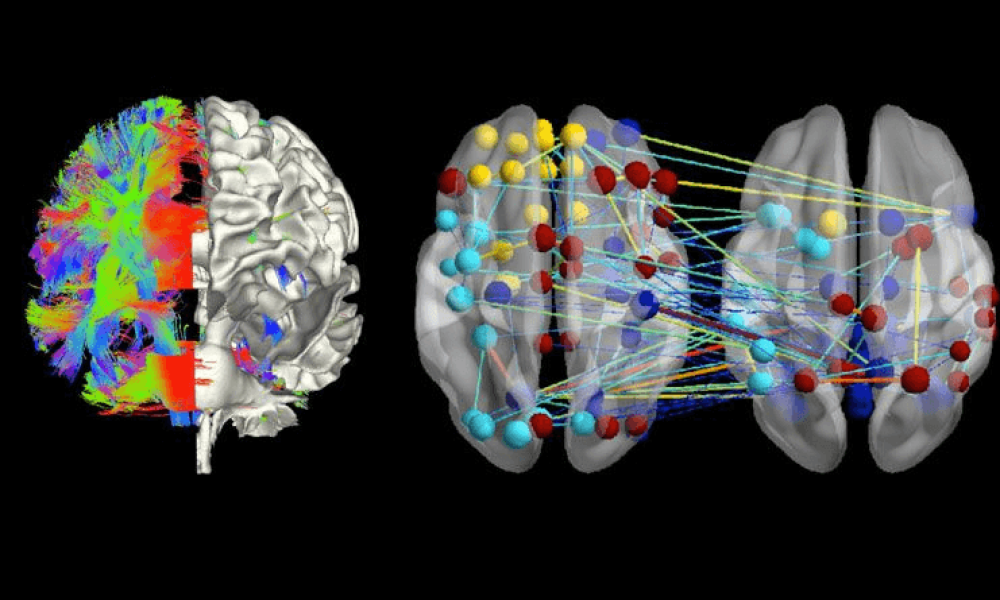 Global Brain Imaging and Neuroimaging Market on a Transformative Path ...