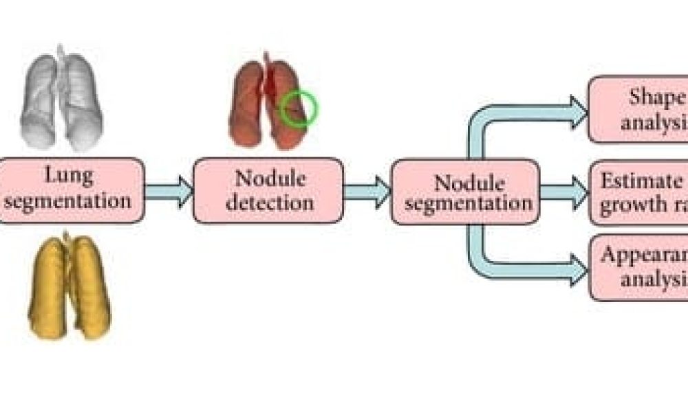 Computer Aided Detection System Market Thriving Worldwide: Hologic ...