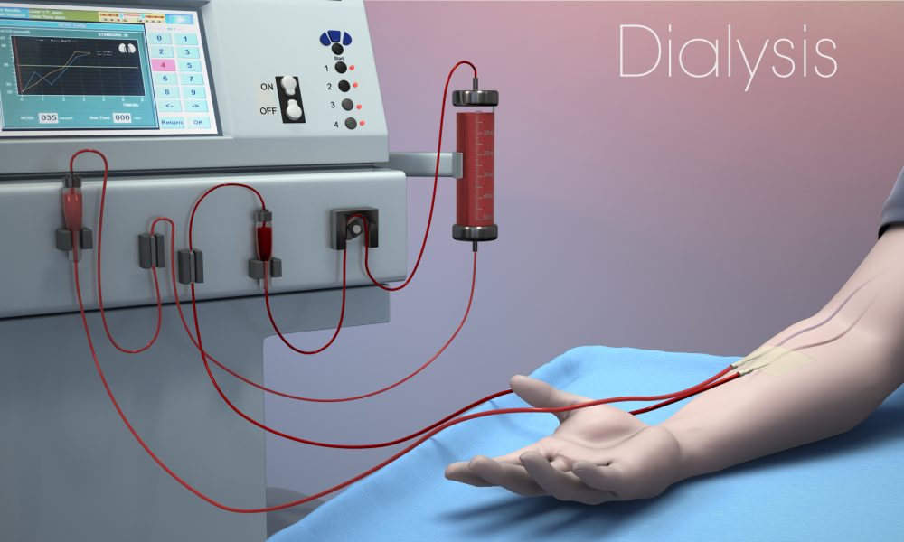 Dialysis Products and Service Market Hits New High | Major Giants ...
