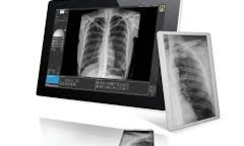 Digital Radiography Market: A Comprehensive Study Exploring with Canon ...