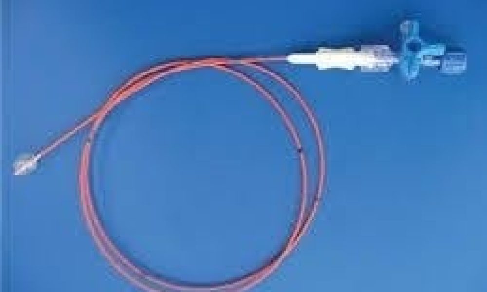 Embolectomy Balloon Catheter Market SWOT Analysis (2024-2030) - Newstrail