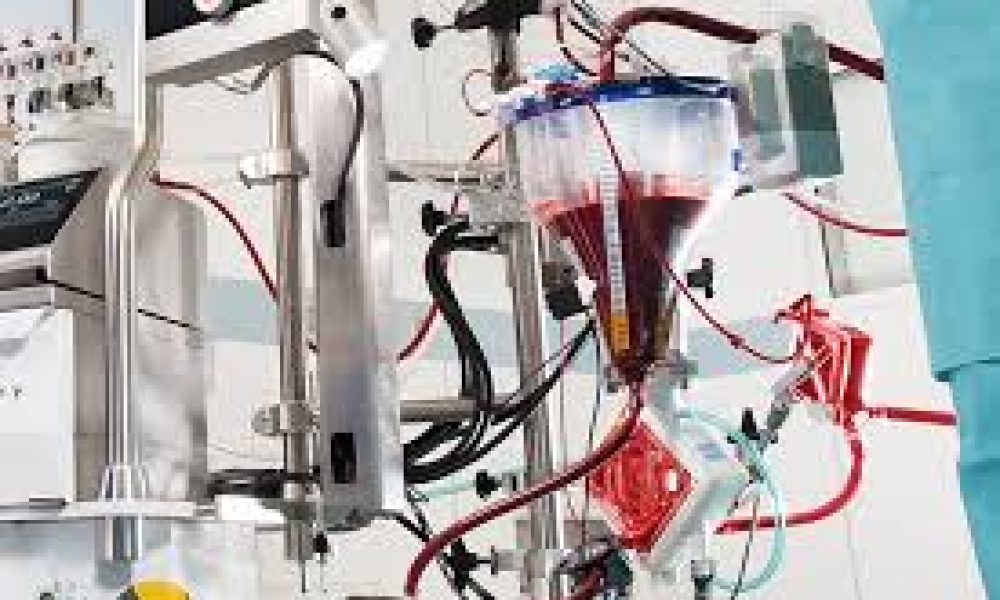 Heart Surgery Perfusion Service Market Set for Explosive Growth ...