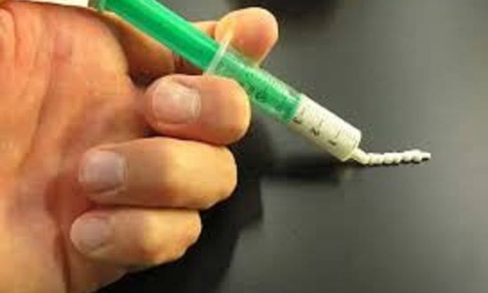 Injectable Cement Market to Witness Impressive Growth by 2030 : Stryker ...