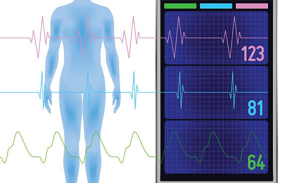 Mobile Cardiac Telemetry Systems Market Dynamics: Regional Breakdown ...