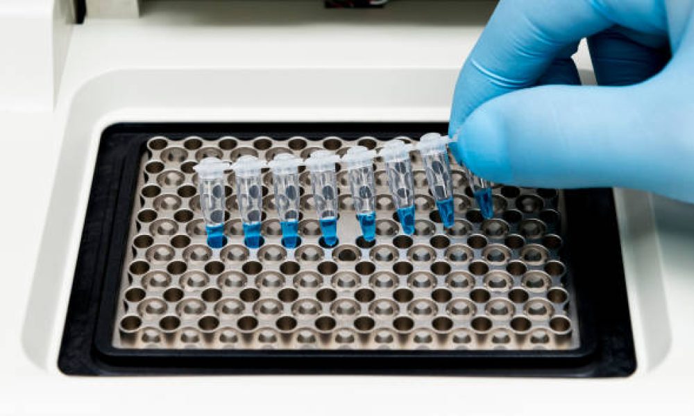 NGS Sample Preparation Market Sector Outlook: Beyond the Curve in a ...