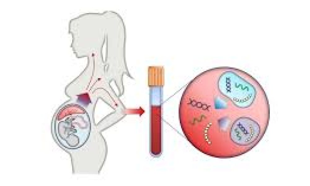 Non-Invasive Prenatal Testing Market May See a Big Move | Major Giants ...