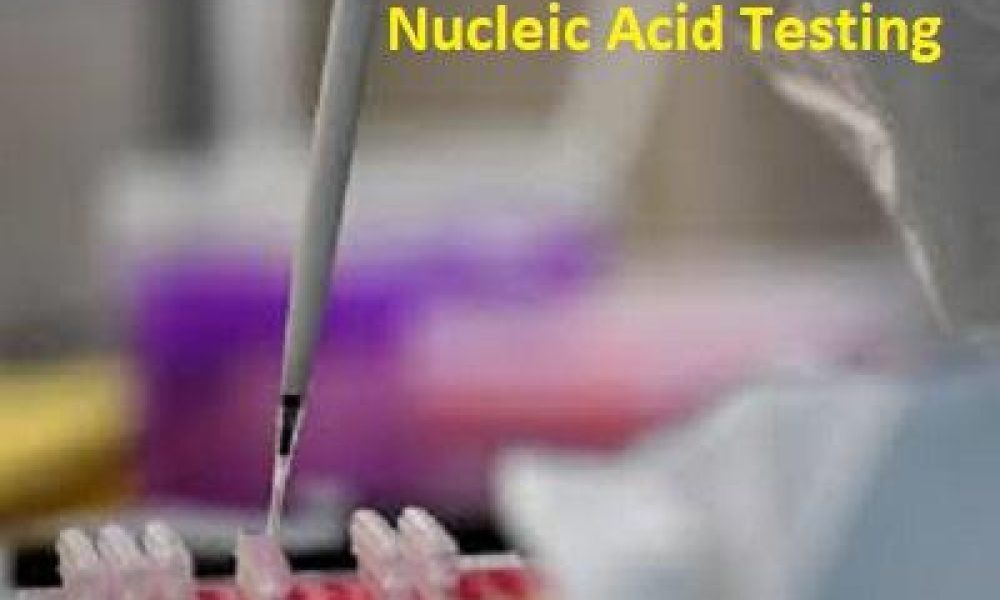 Nucleic Acid Testing Market Worth Observing Growth: Beckman Coulter ...