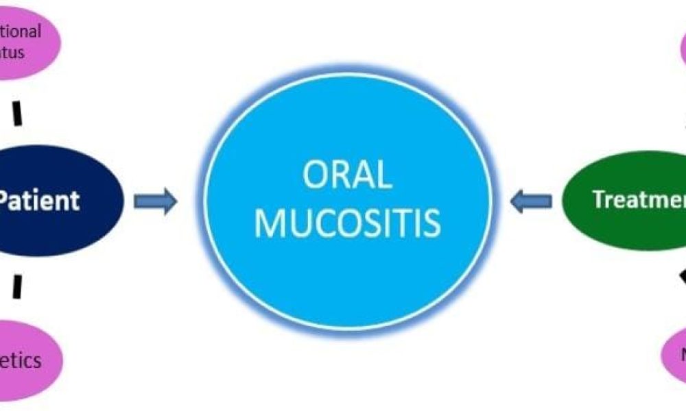 Oral Mucositis Drug Market constantly growing to See Bigger Picture ...