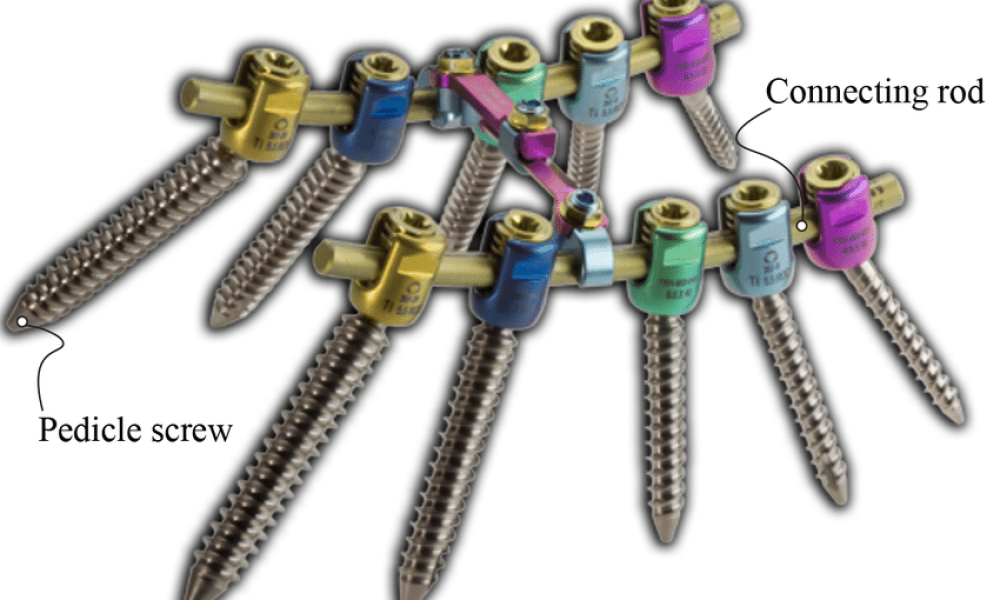 Pedicle Screw Rod System Market Forecast: What You Need To Know ...