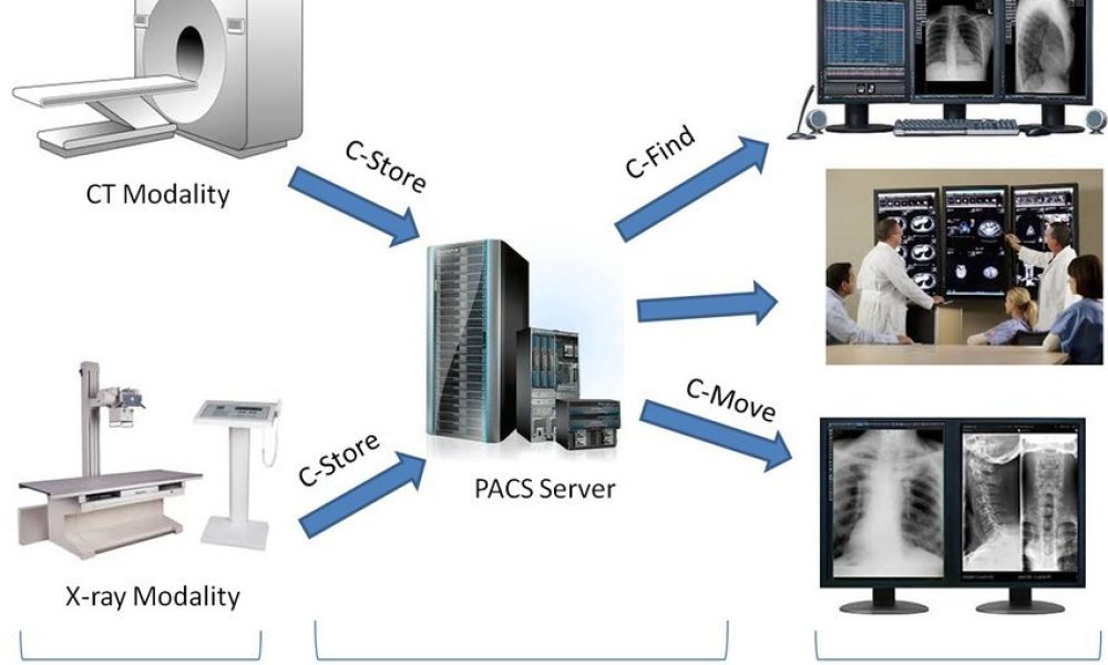 Picture Archiving And Communication System (PACS) Market Grows as Hospitals Modernize Imaging ...