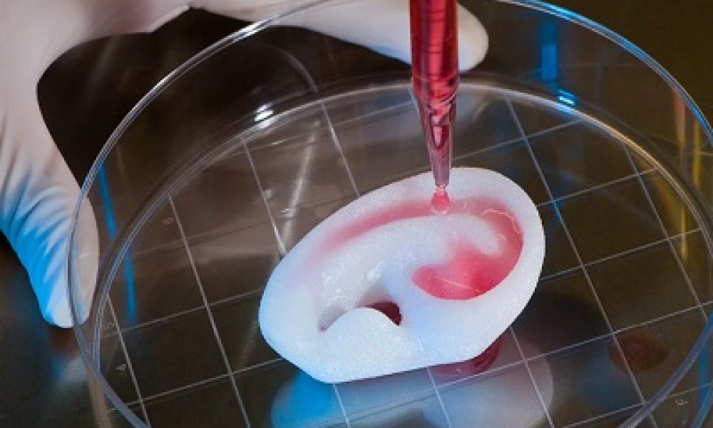 Regenerative Medicine Products Market begins to take bite out of ...