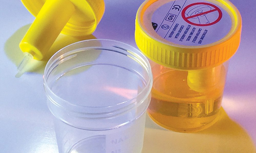 Urine Testing Cups Market Moving in the Right Direction: Alere,, MPD ...