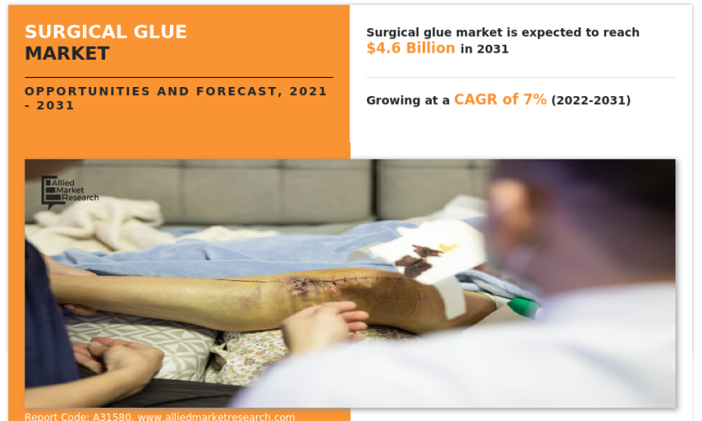 Surgical Glue Market: An Expanding Frontier in Modern Surgery - Newstrail